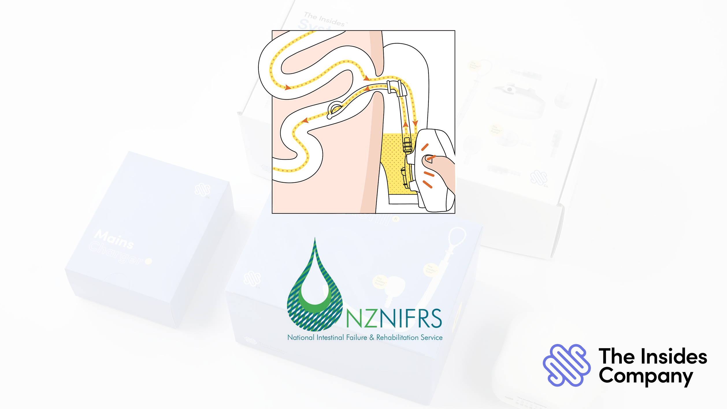 Chyme Reinfusion Included in NZ NIFRS Clinical Guidelines